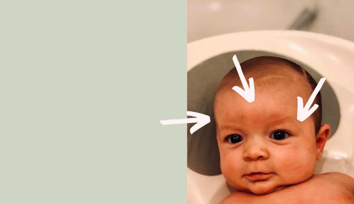 Why Have My Babies Eyebrows Gone Red?